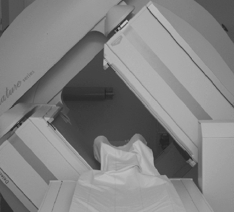 Slingeland Ziekenhuis - patiëntfolder: DaT-scan van de hersenen